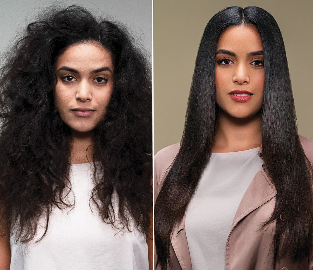 NKST – Keratin Complex